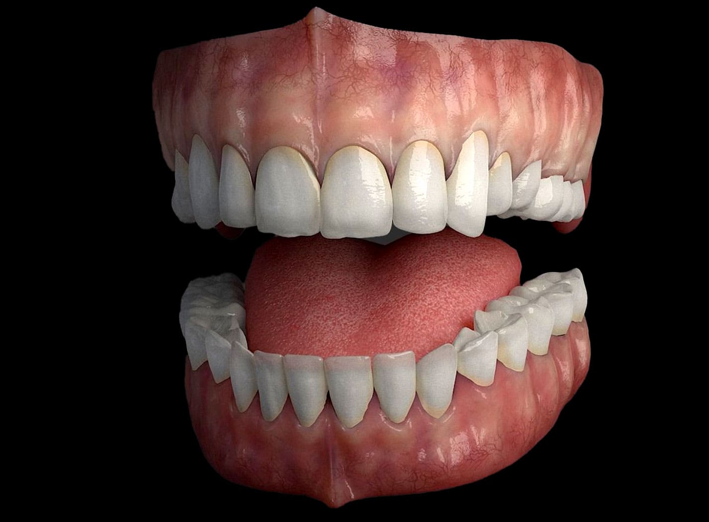 Dental Diseases | Periodontology - Medicadent | Biological and Holistic ...