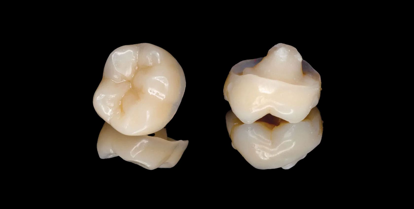 Endocrown - Medicadent | Biological and Holistic Dentistry | Since 1988