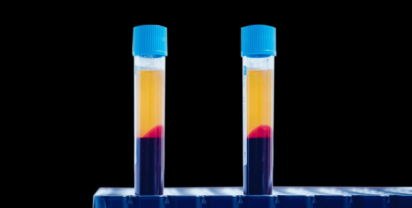 Prf | Prp Treatments - Medicadent | Biological and Holistic Dentistry ...