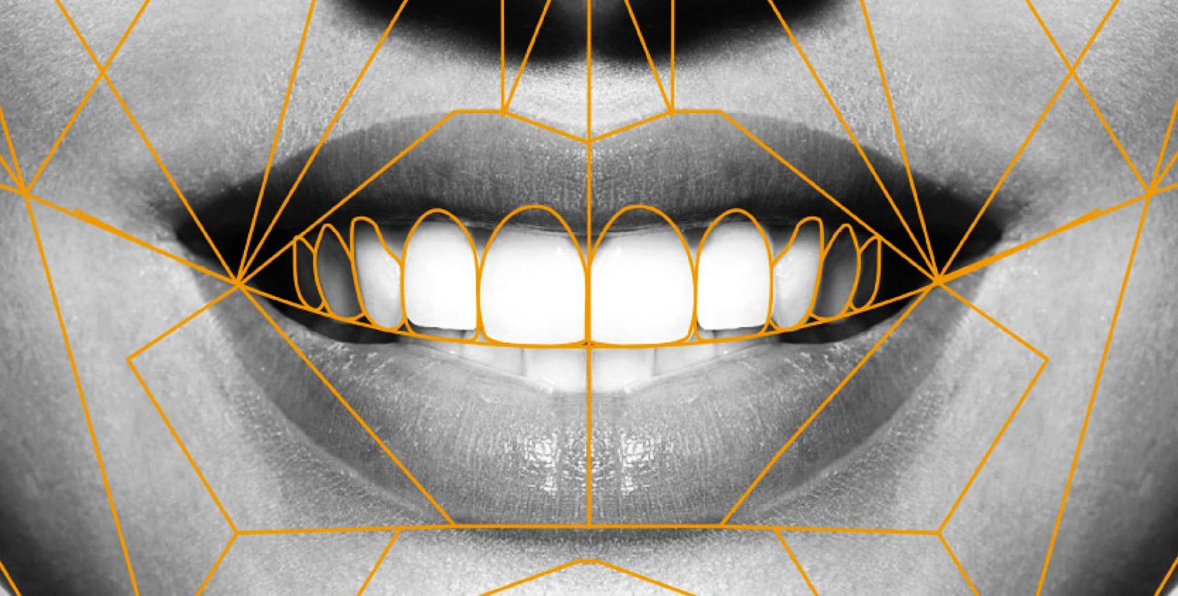 Recontouring | Gülüş Tasarımı | Estetik Diş Hekimliği - Medicadent